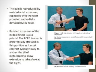 Elbow injuries | PPTX