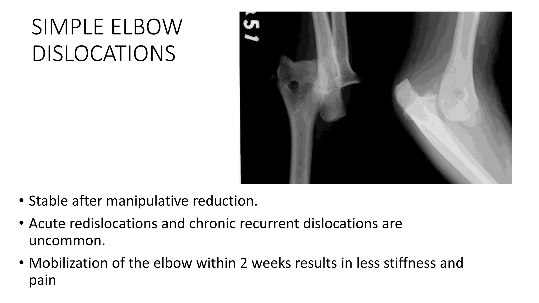 Elbow Injuriespptx