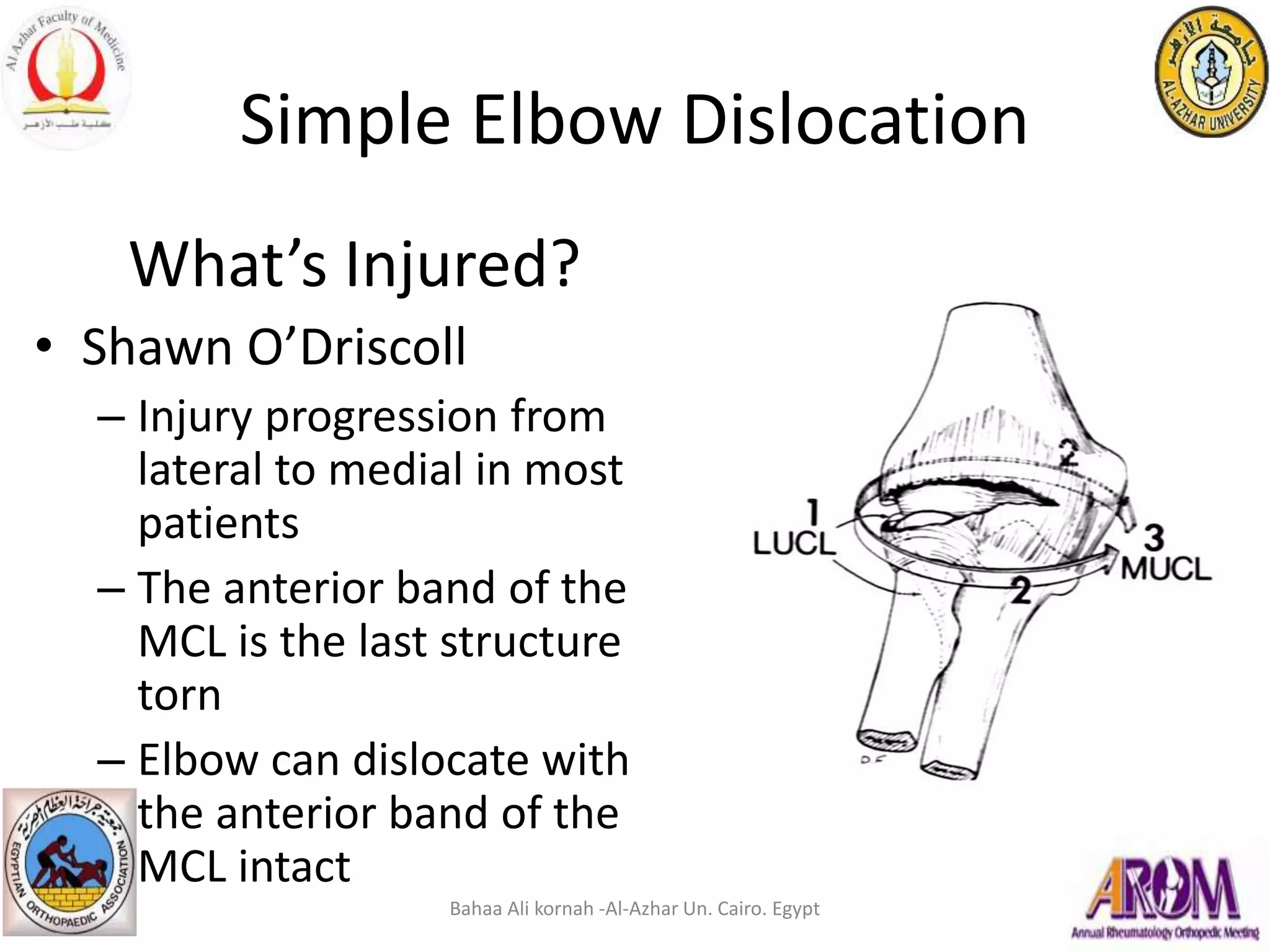 Elbow instability | PPT