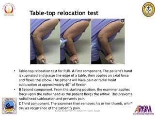 Elbow instability | PPT