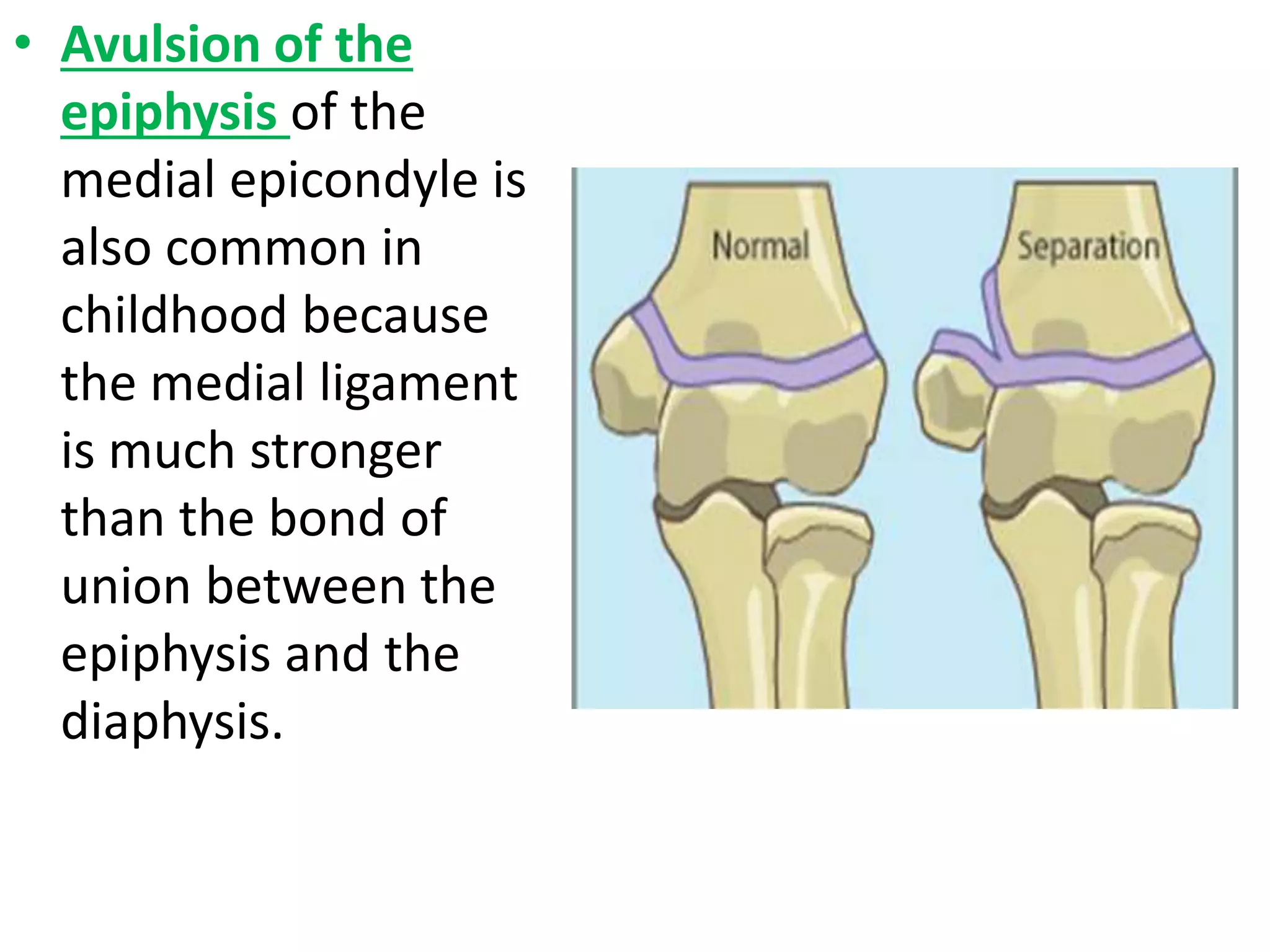 elbow join & lymphatics of upper limbt.pptx