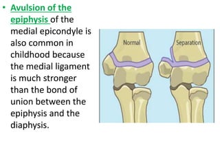 elbow join & lymphatics of upper limbt.pptx