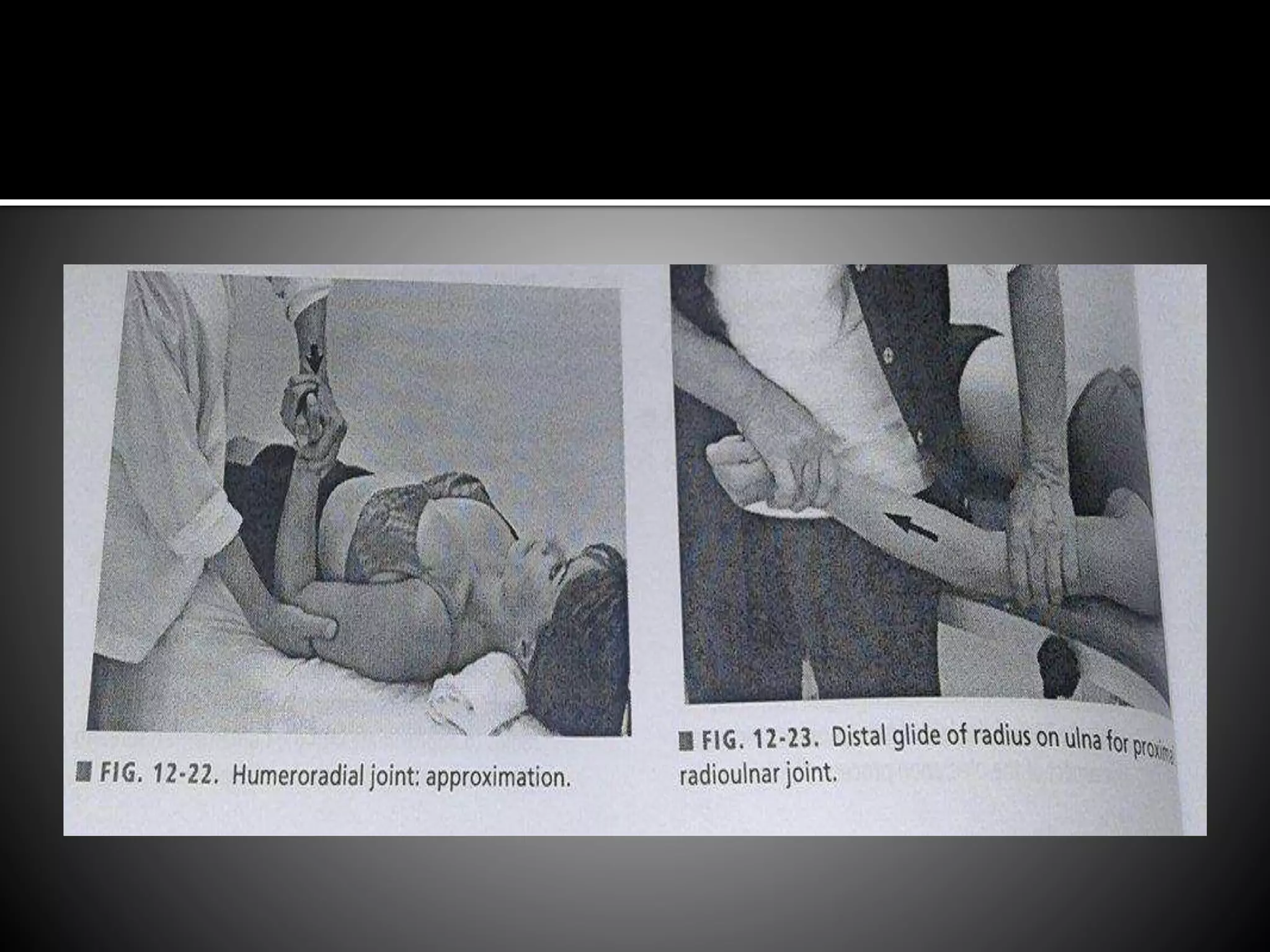 Elbow joint Mobilization Techniques (Darlene Hertling) | PPTX