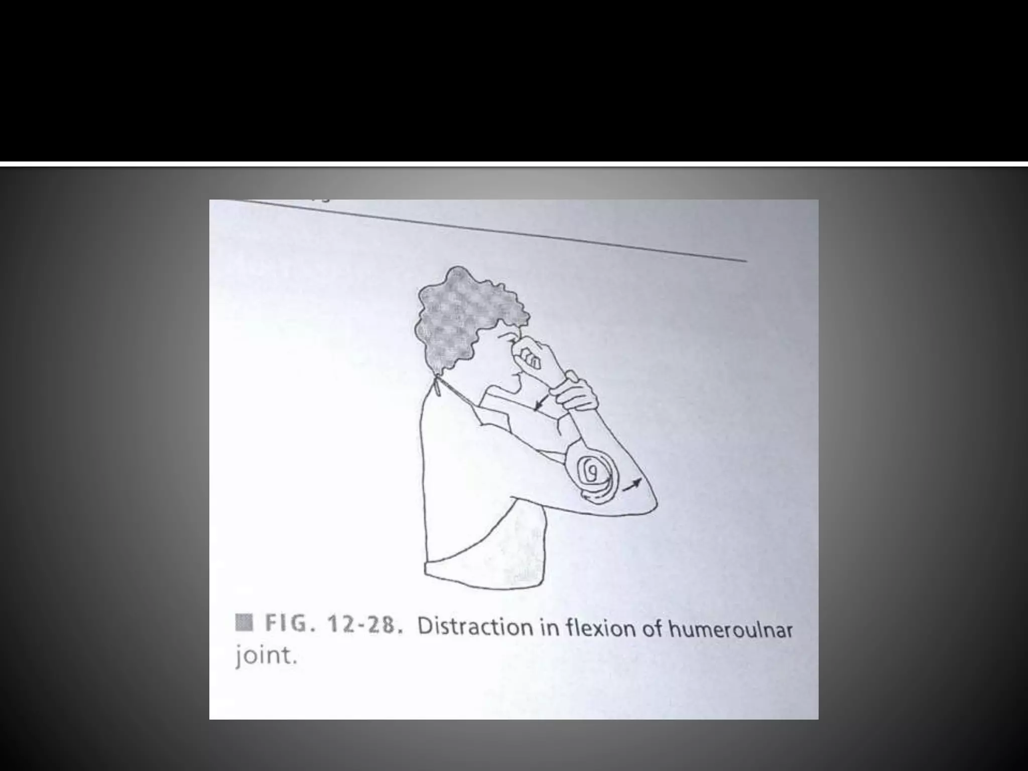 Elbow joint Mobilization Techniques (Darlene Hertling) | PPTX