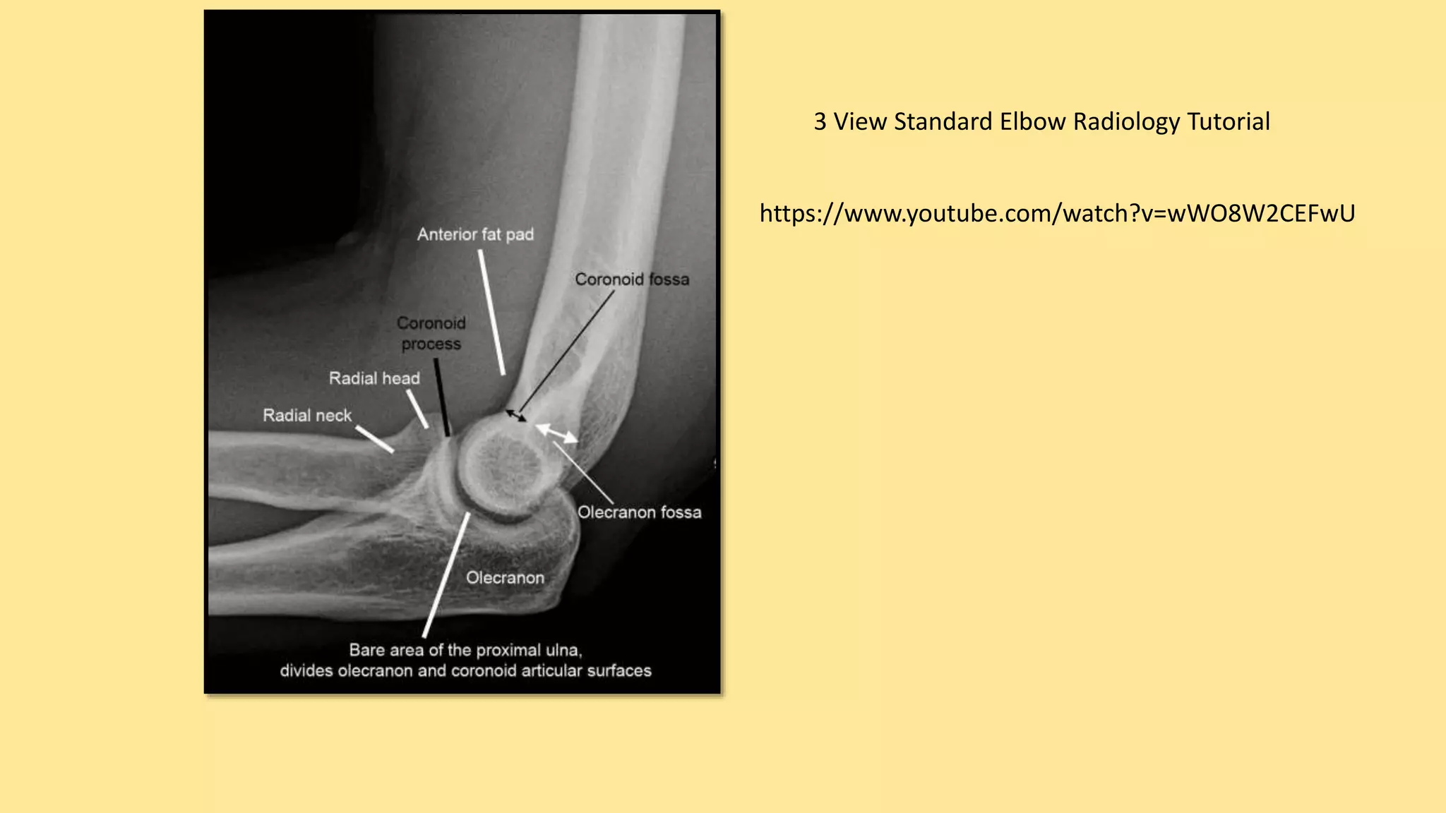 Elbow joint anatomy | PPTX