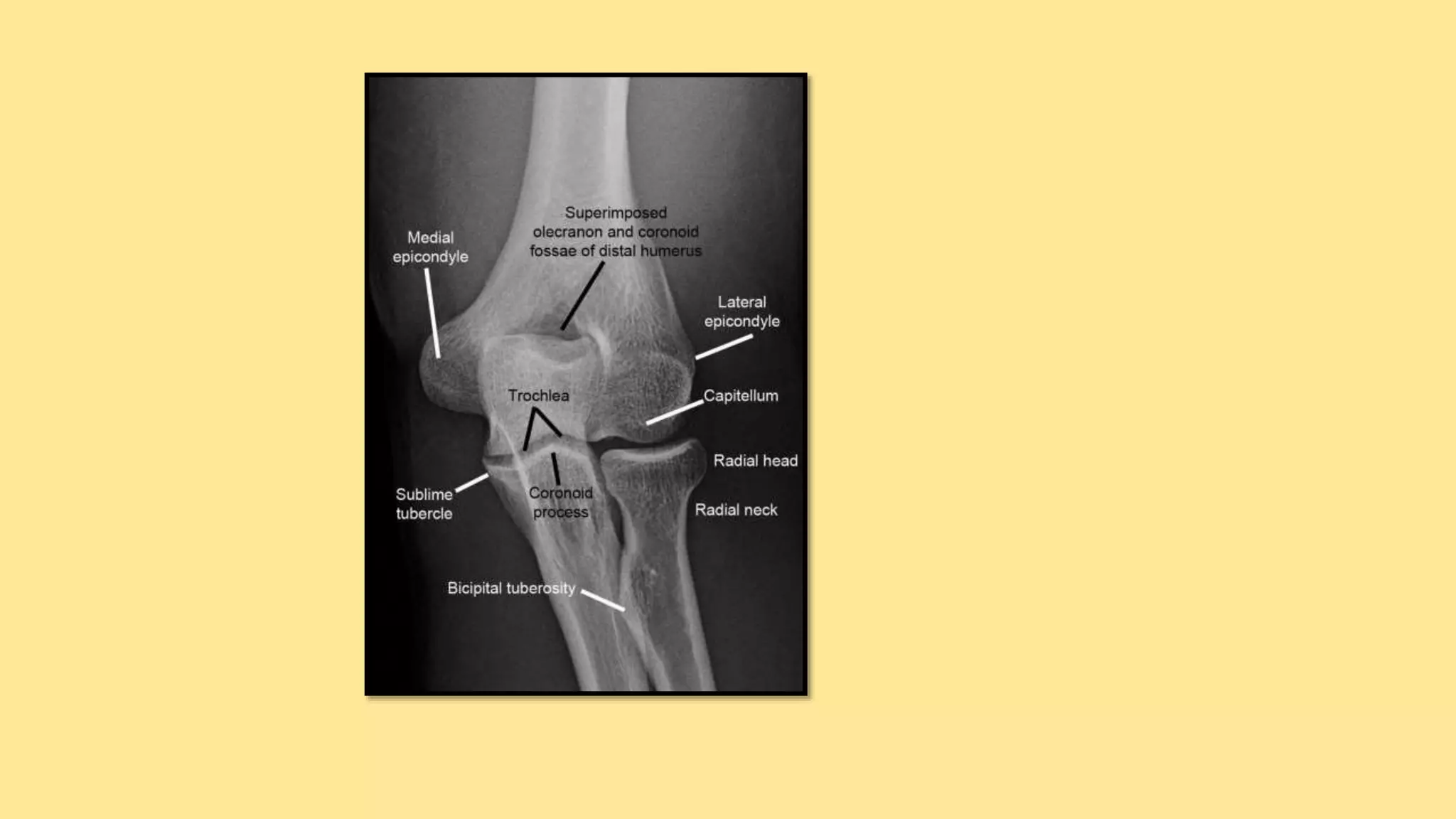 Elbow joint anatomy | PPTX