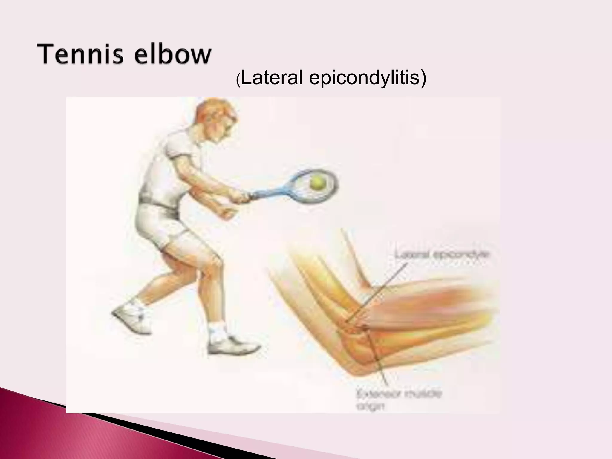 elbow joint .ppt