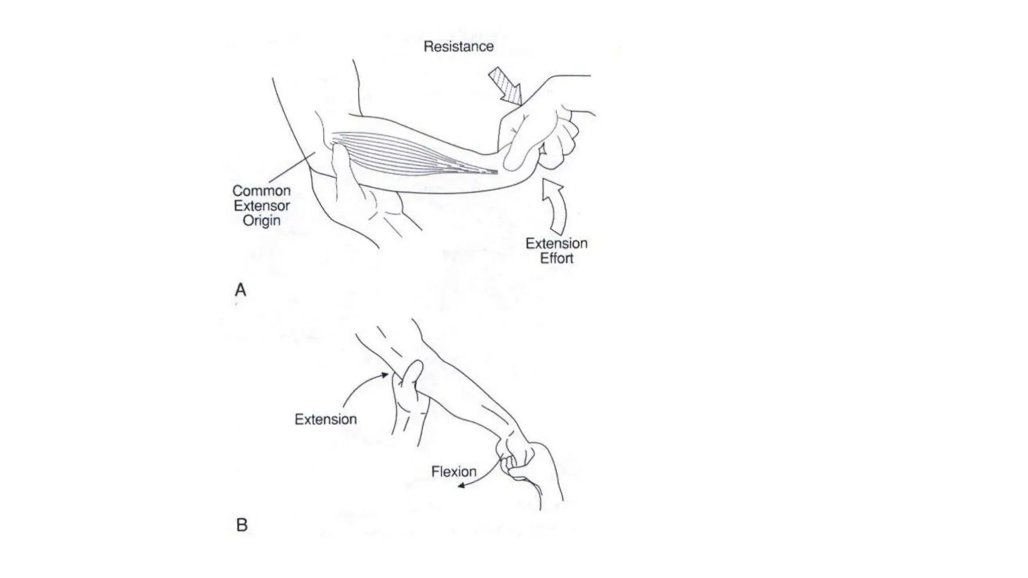 anatomy and deformities of Elbow Joint.pptx