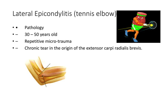 anatomy and deformities of Elbow Joint.pptx