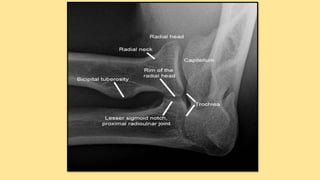 Elbow Joint.pptx of anatomy and histology | PPTX