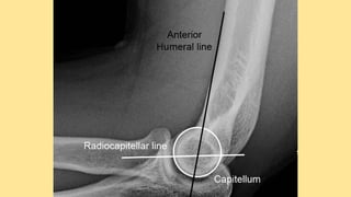 Elbow Joint.pptx of anatomy and histology | PPTX