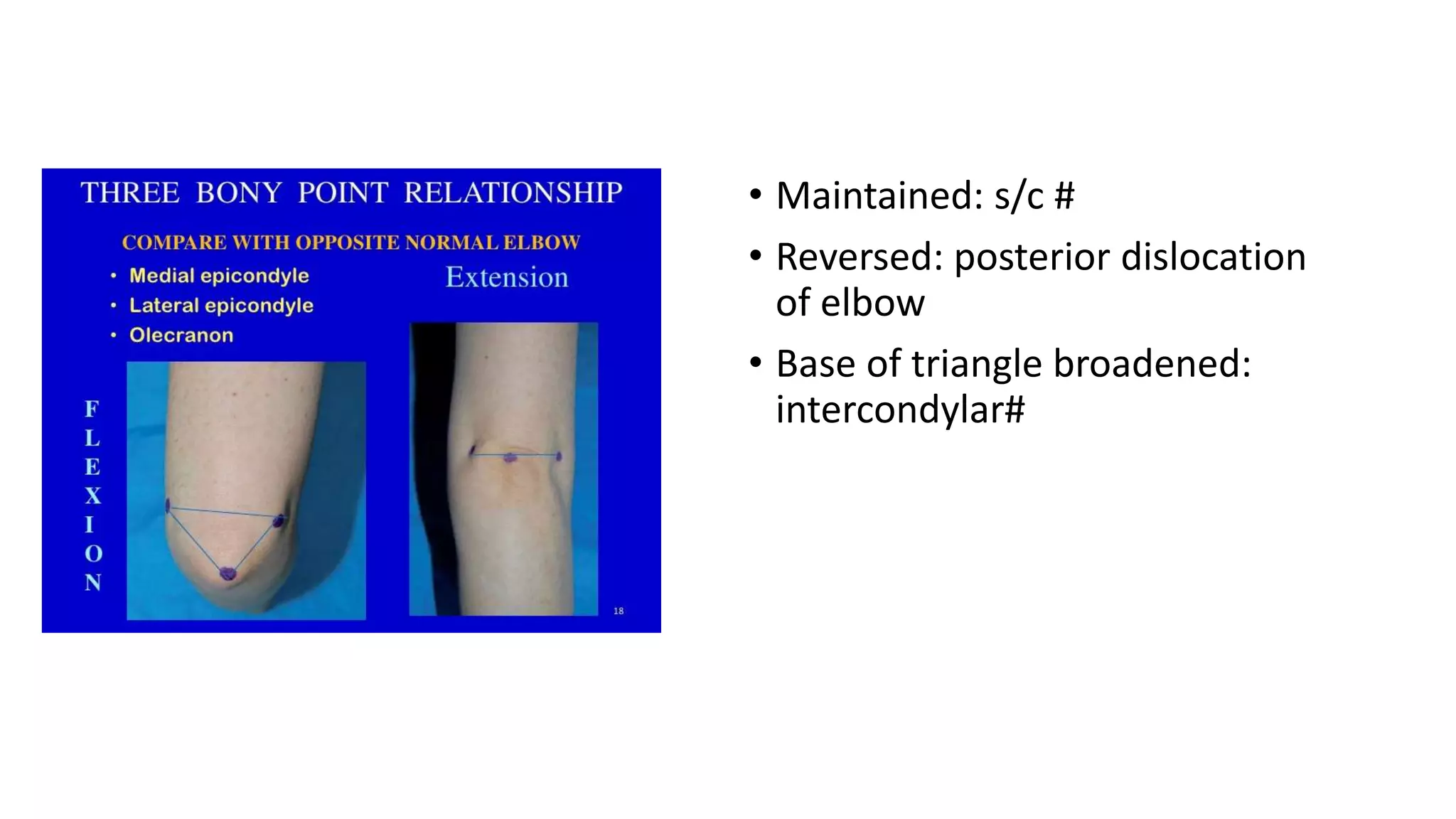 Elbow joint anatomy and examination | PPTX