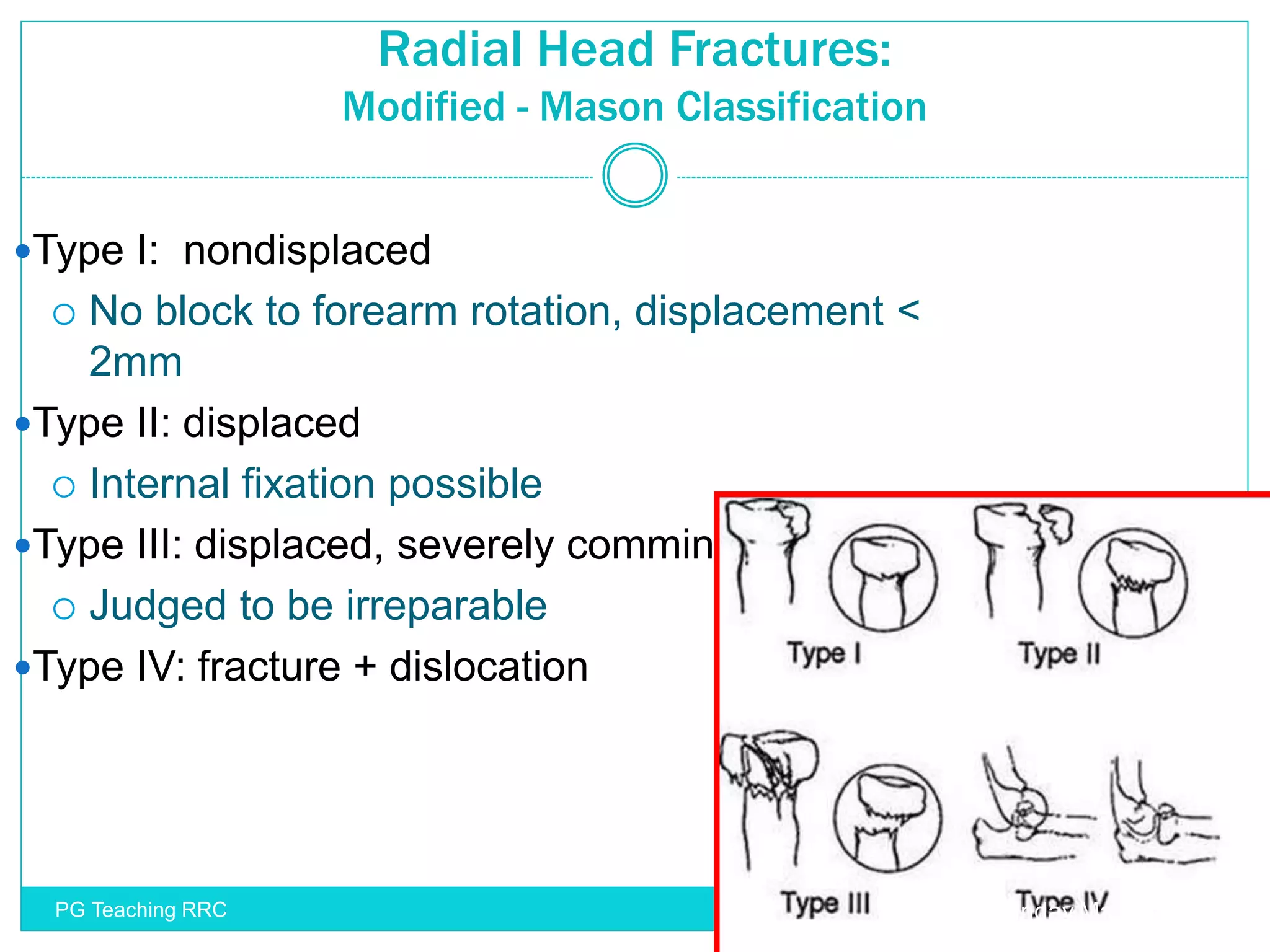 Elbow trauma & infection | PPTX