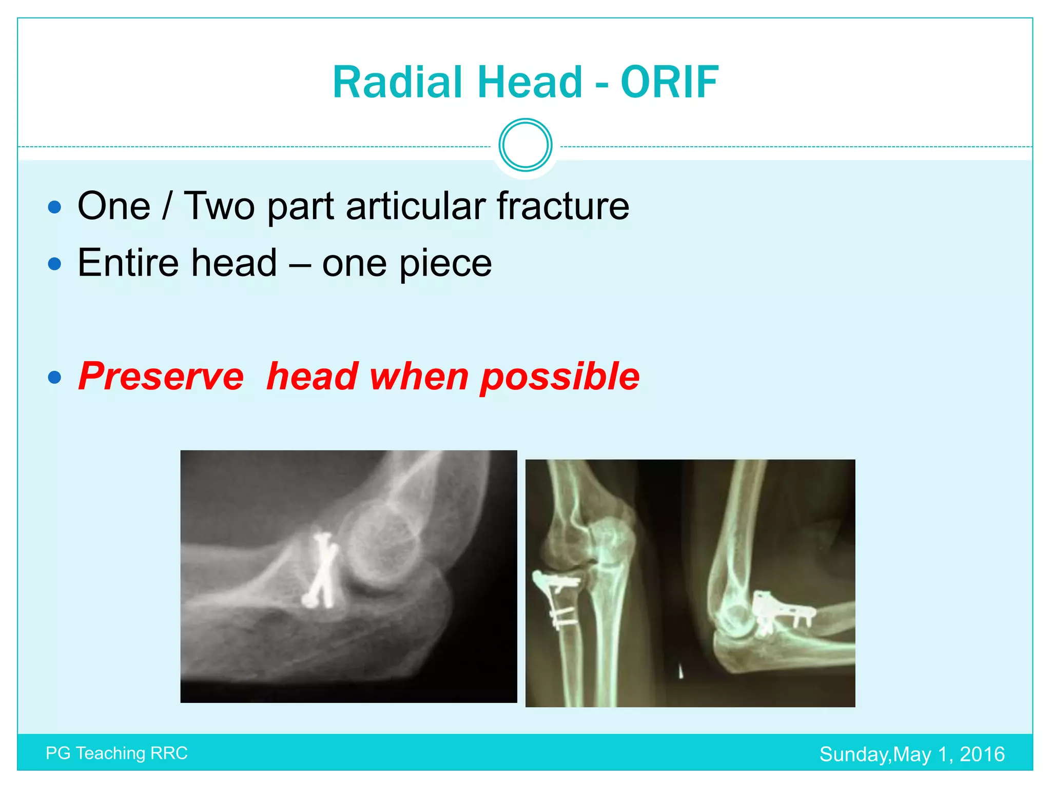 Elbow trauma & infection | PPTX