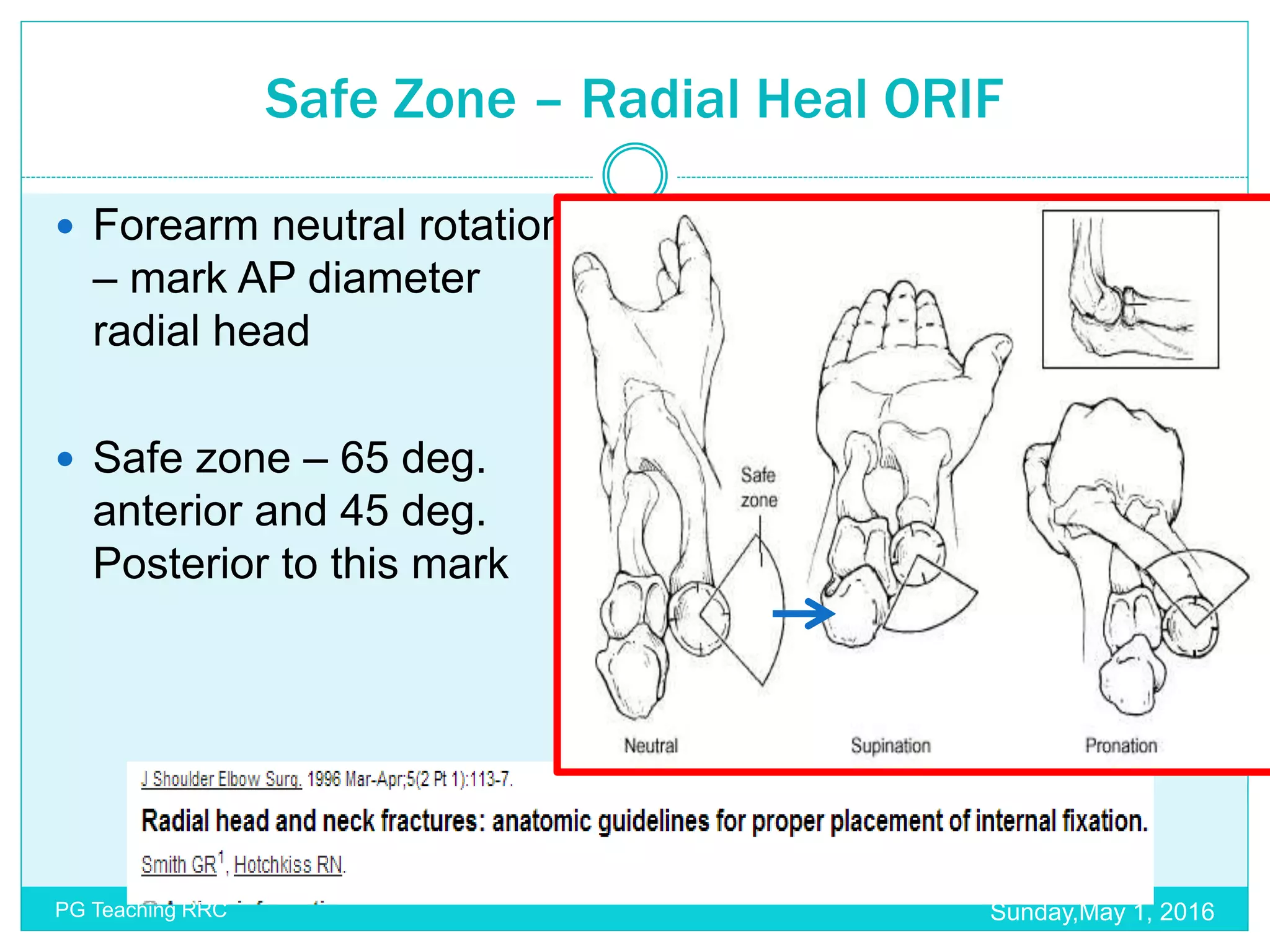 Elbow trauma & infection | PPTX