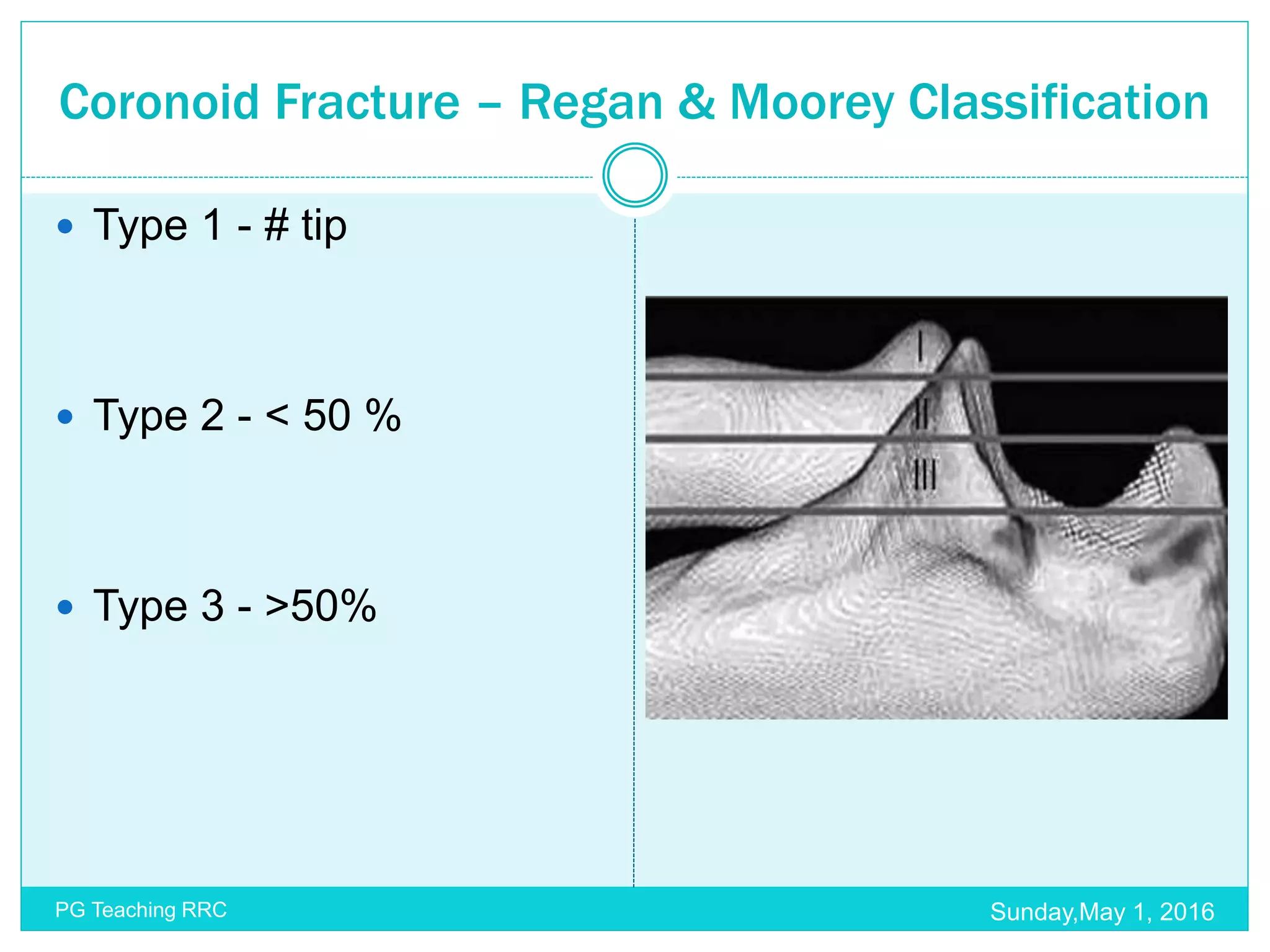 Elbow trauma & infection | PPTX