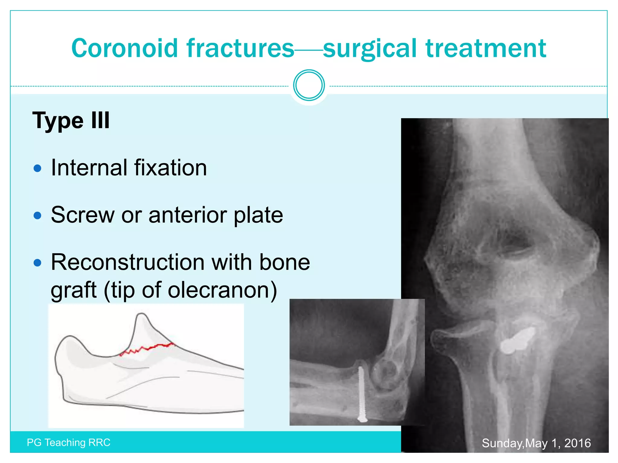 Elbow trauma & infection | PPTX