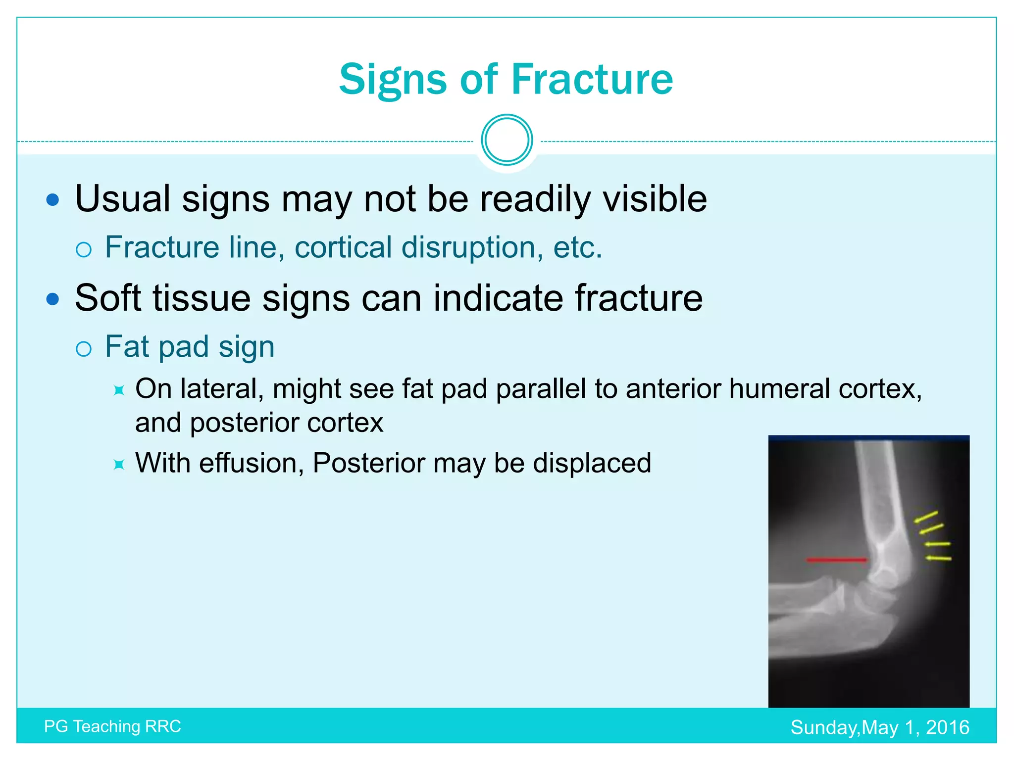Elbow trauma & infection | PPTX