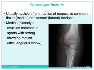 Elbow trauma & infection | PPTX