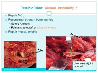 Elbow trauma & infection | PPTX