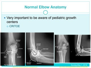 Elbow trauma & infection | PPTX