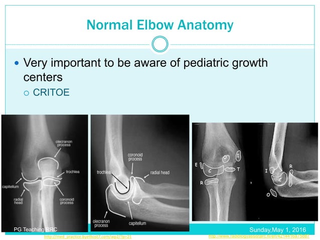 Elbow trauma & infection | PPT
