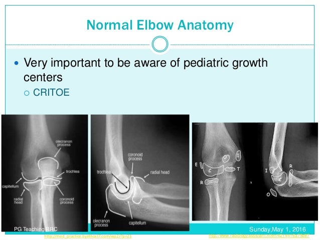 Elbow trauma & infection