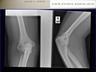 Elbow joint imaging | PPT
