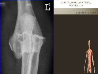Elbow joint imaging | PPSX