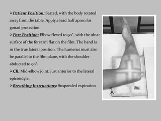 Elbow joint | PPTX