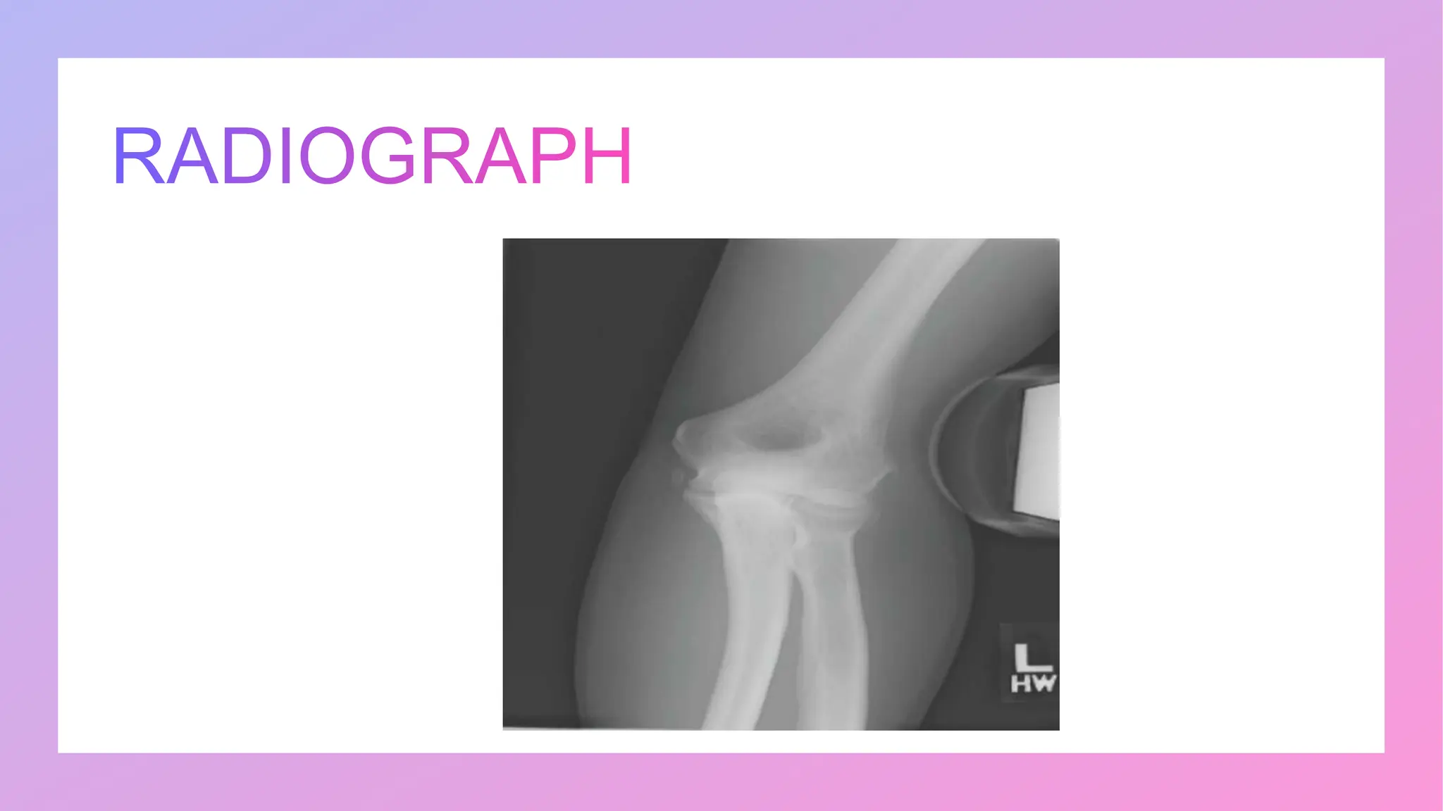 ELBOW JOINT PATHOLOGY AND REHABILITATION 1.pptx