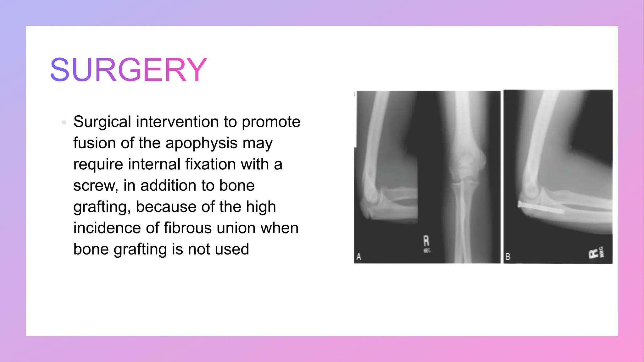 ELBOW JOINT PATHOLOGY AND REHABILITATION 1.pptx