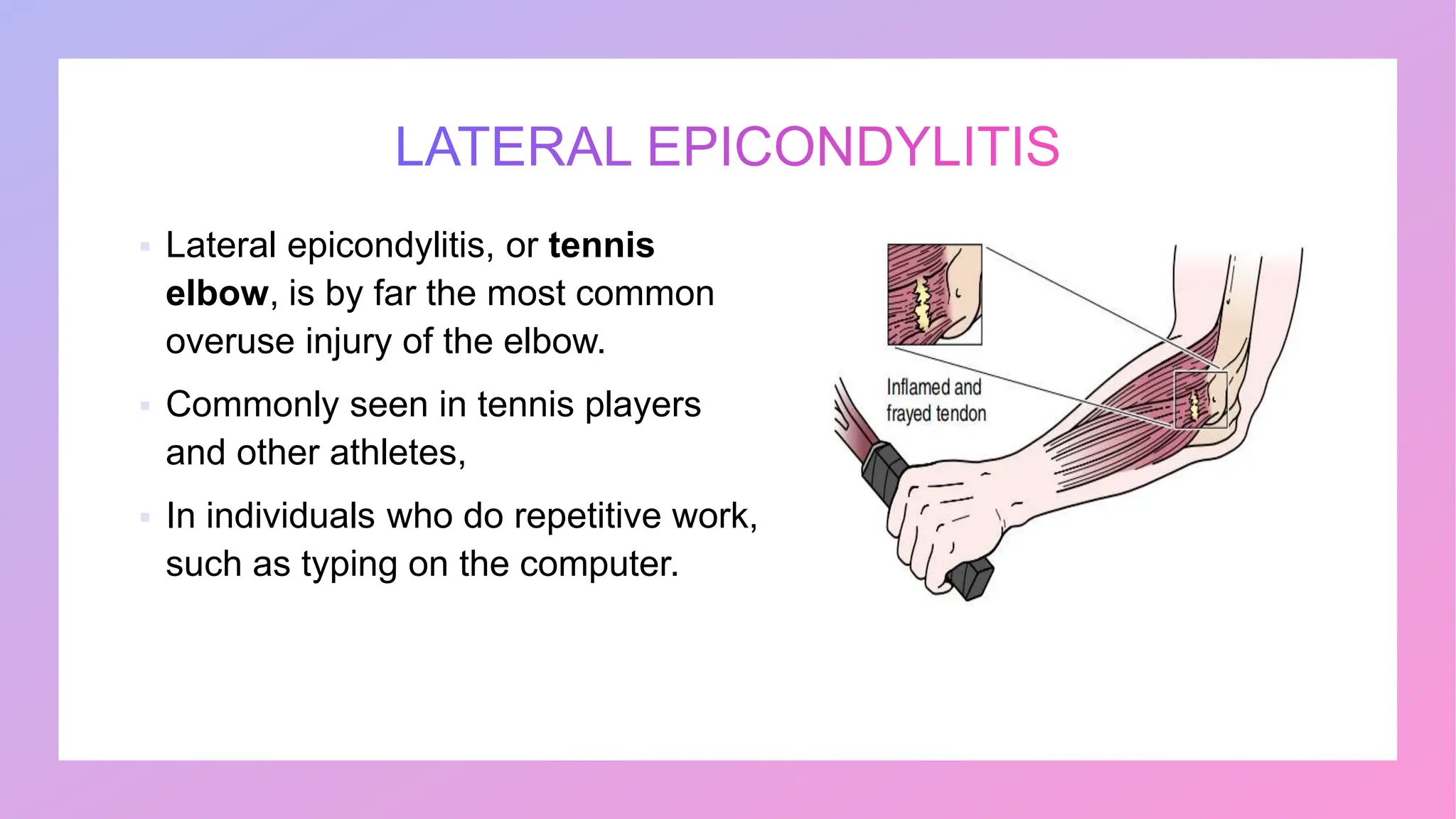 ELBOW JOINT PATHOLOGY AND REHABILITATION 1.pptx