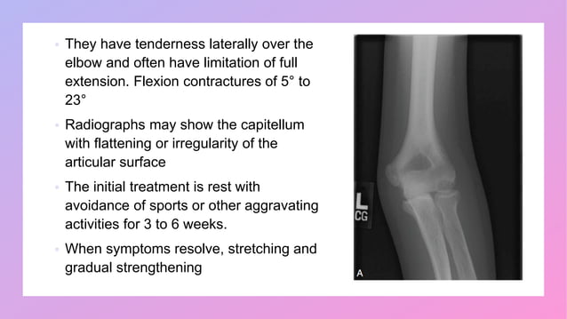 ELBOW JOINT PATHOLOGY AND REHABILITATION 1.pptx