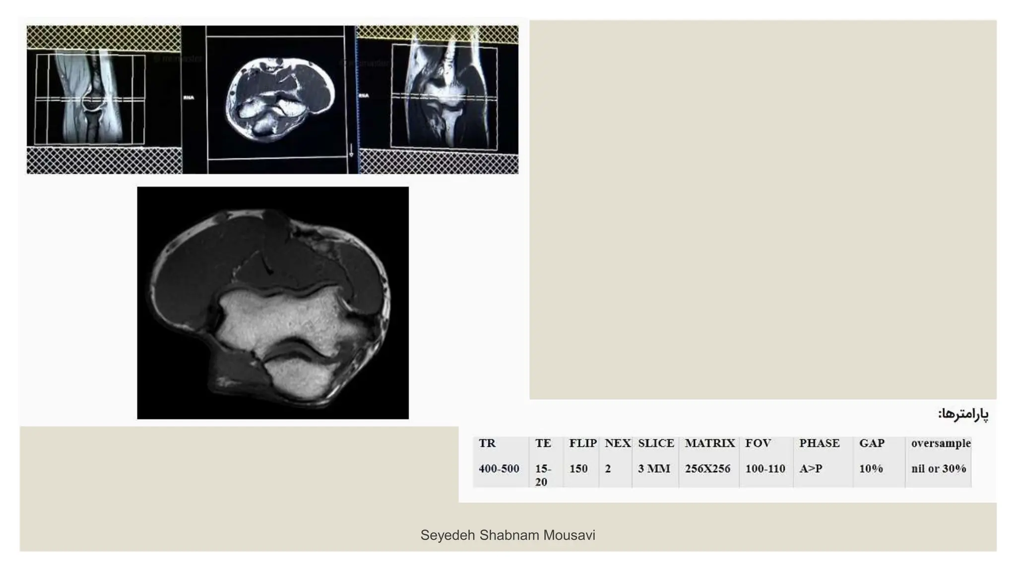 Elbow MRI.pptxPositioning. Technique. Physics. Anatomy. | PPT