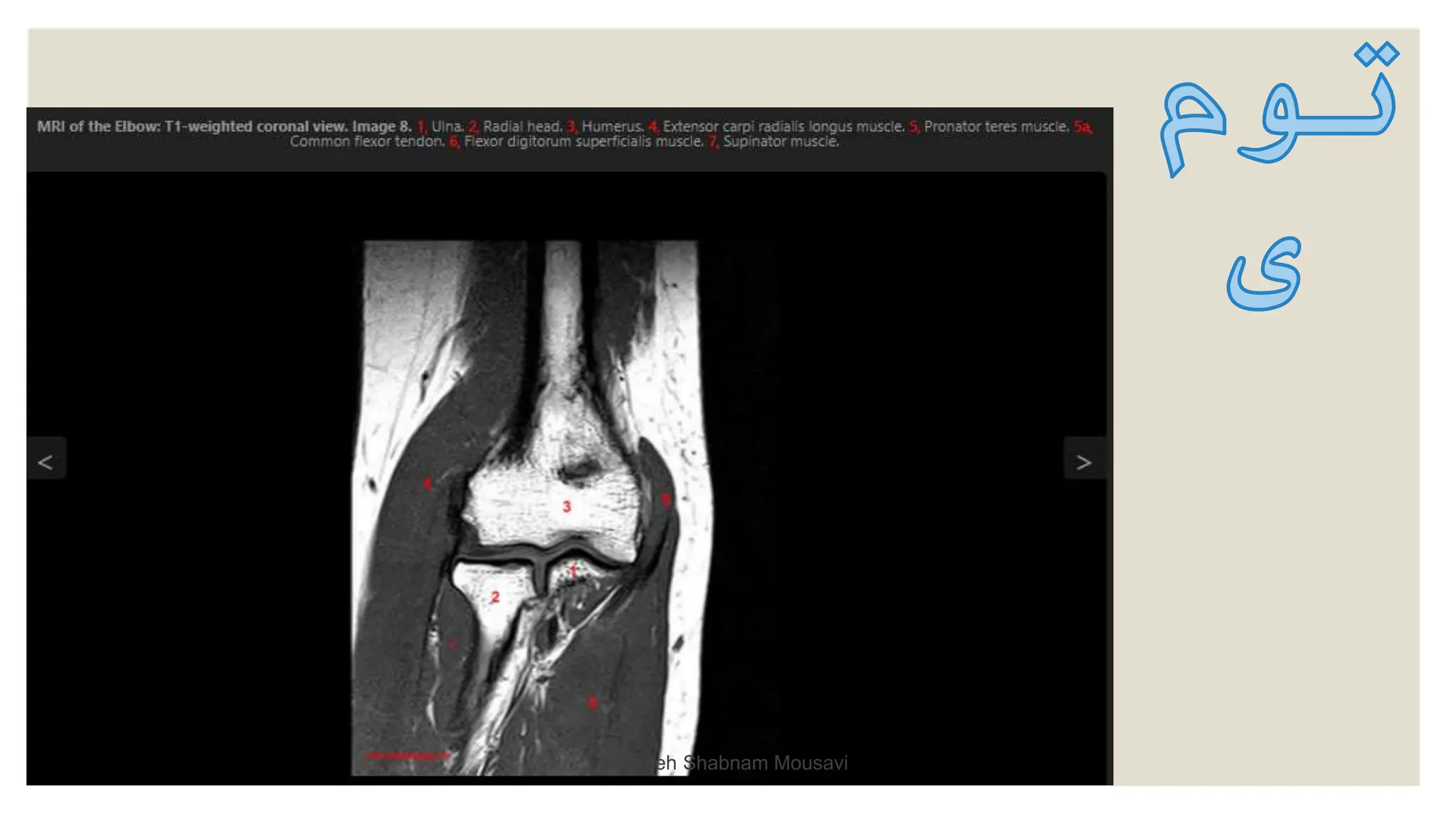 Elbow MRI.pptxPositioning. Technique. Physics. Anatomy. | PPT