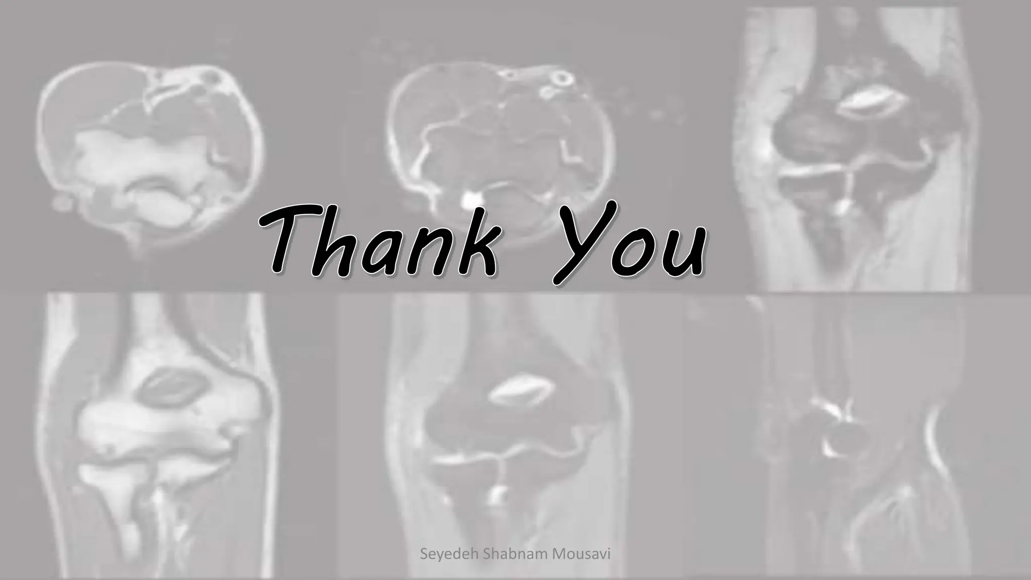 Elbow MRI.pptxPositioning. Technique. Physics. Anatomy. | PPT