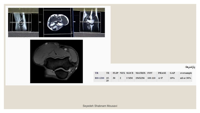 Elbow MRI.pptxPositioning. Technique. Physics. Anatomy. | PPT