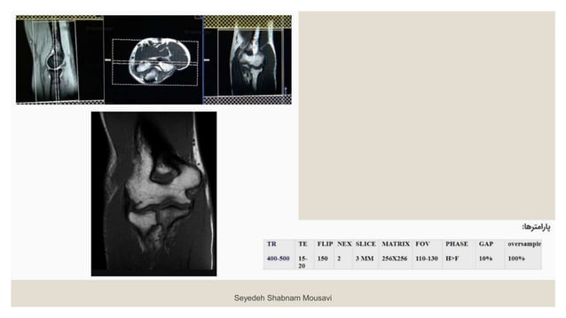 Elbow MRI.pptxPositioning. Technique. Physics. Anatomy. | PPT