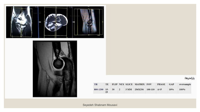 Elbow MRI.pptxPositioning. Technique. Physics. Anatomy. | PPT