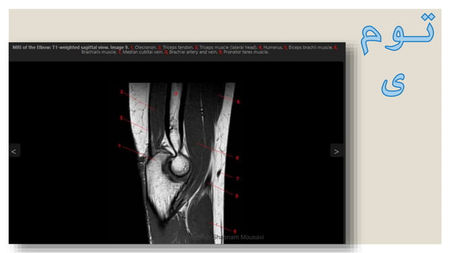 Elbow MRI.pptxPositioning. Technique. Physics. Anatomy. | PPT