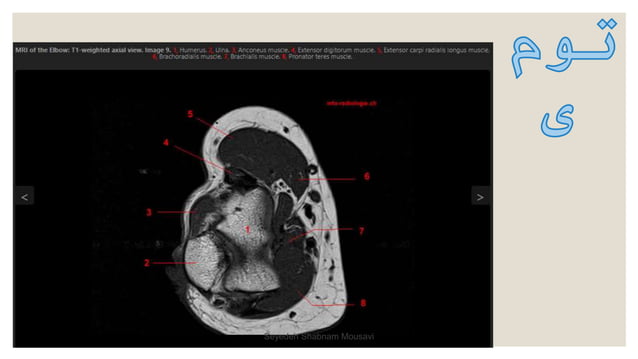 Elbow MRI.pptxPositioning. Technique. Physics. Anatomy. | PPT