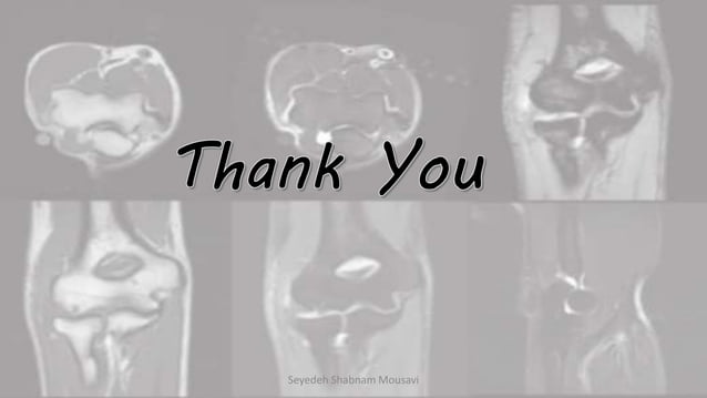 Elbow MRI.pptxPositioning. Technique. Physics. Anatomy. | PPT