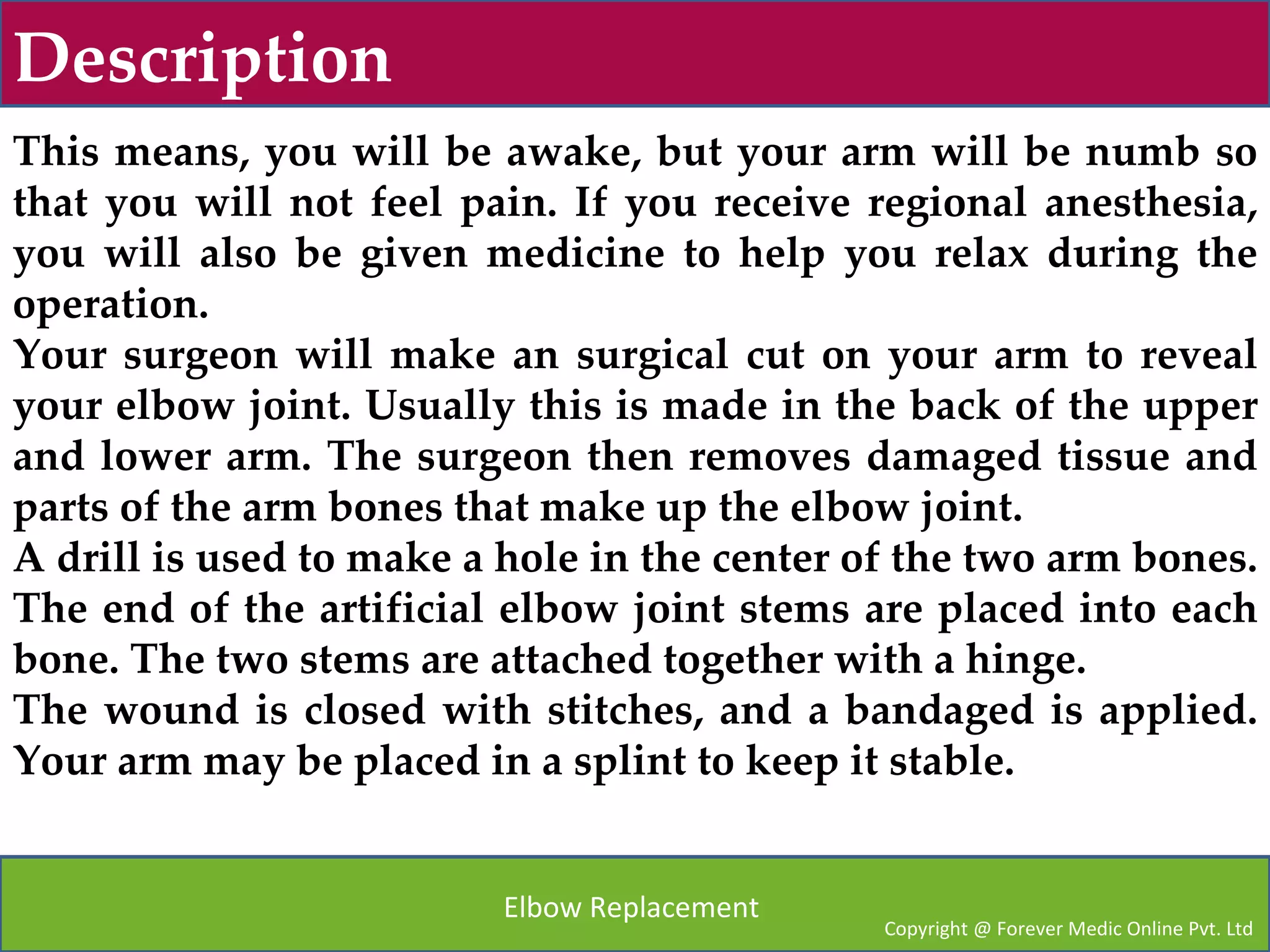 Elbow Replacement surgery & Treatment || Medicyatra | PPT