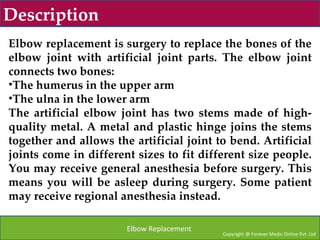 Elbow Replacement surgery & Treatment || Medicyatra | PPT