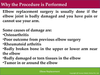 Elbow Replacement surgery & Treatment || Medicyatra | PPT