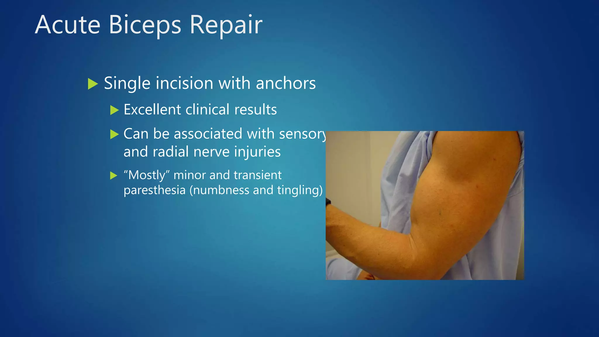 Distal Biceps Tendon Ruptures | Elbow Tendinopathies | South Windsor ...