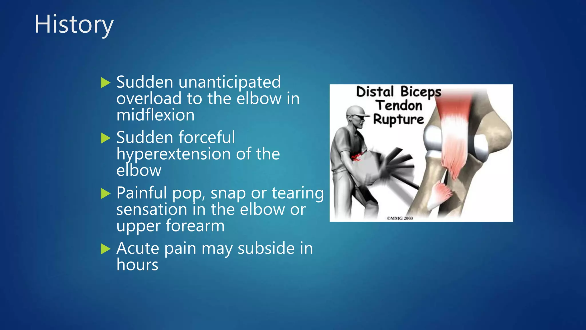 Distal Biceps Tendon Ruptures | Elbow Tendinopathies | South Windsor ...