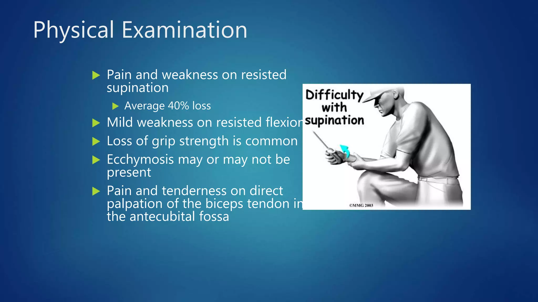 Distal Biceps Tendon Ruptures | Elbow Tendinopathies | South Windsor ...