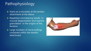 Distal Biceps Tendon Ruptures | Elbow Tendinopathies | South Windsor ...